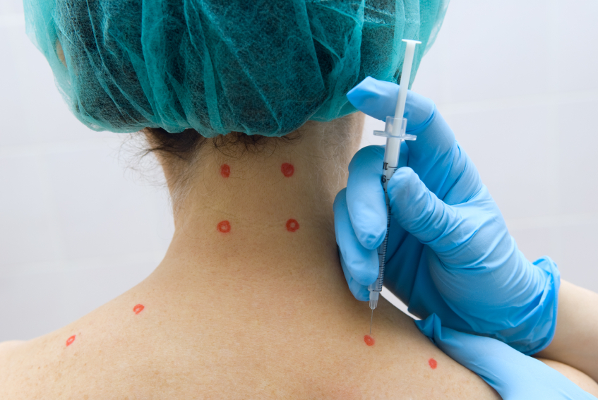 TRIGGER POINT INJECTION – Dr. Hassan Karachi Pain Clinic